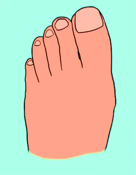 Types of Toes