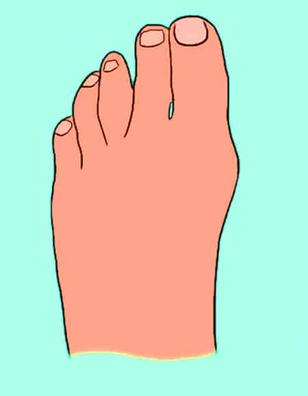 Types of Toes