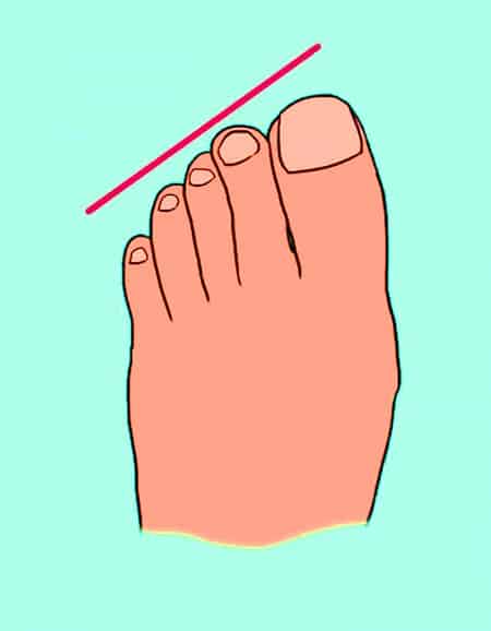 Types of Toes