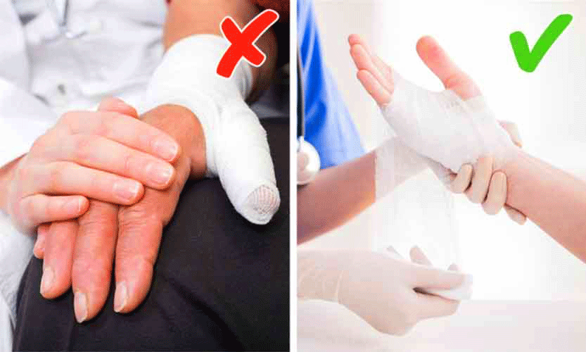 Top 10+ quick tips on first aid that can save your day | Home
