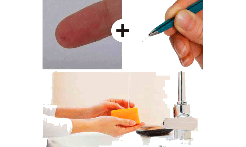 Top 10+ quick tips on first aid that can save your day | Home